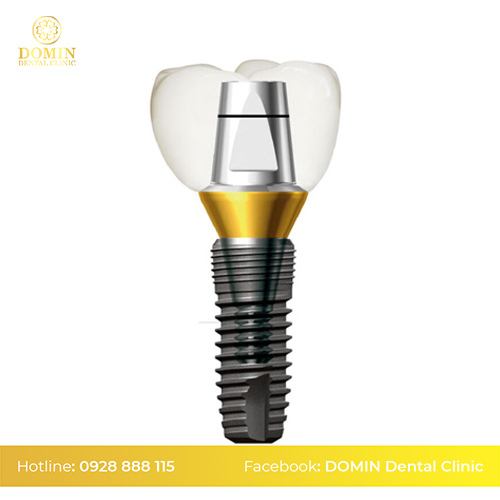 Implant SuperLine (USA) - Nha Khoa Thẩm Mỹ DOMIN