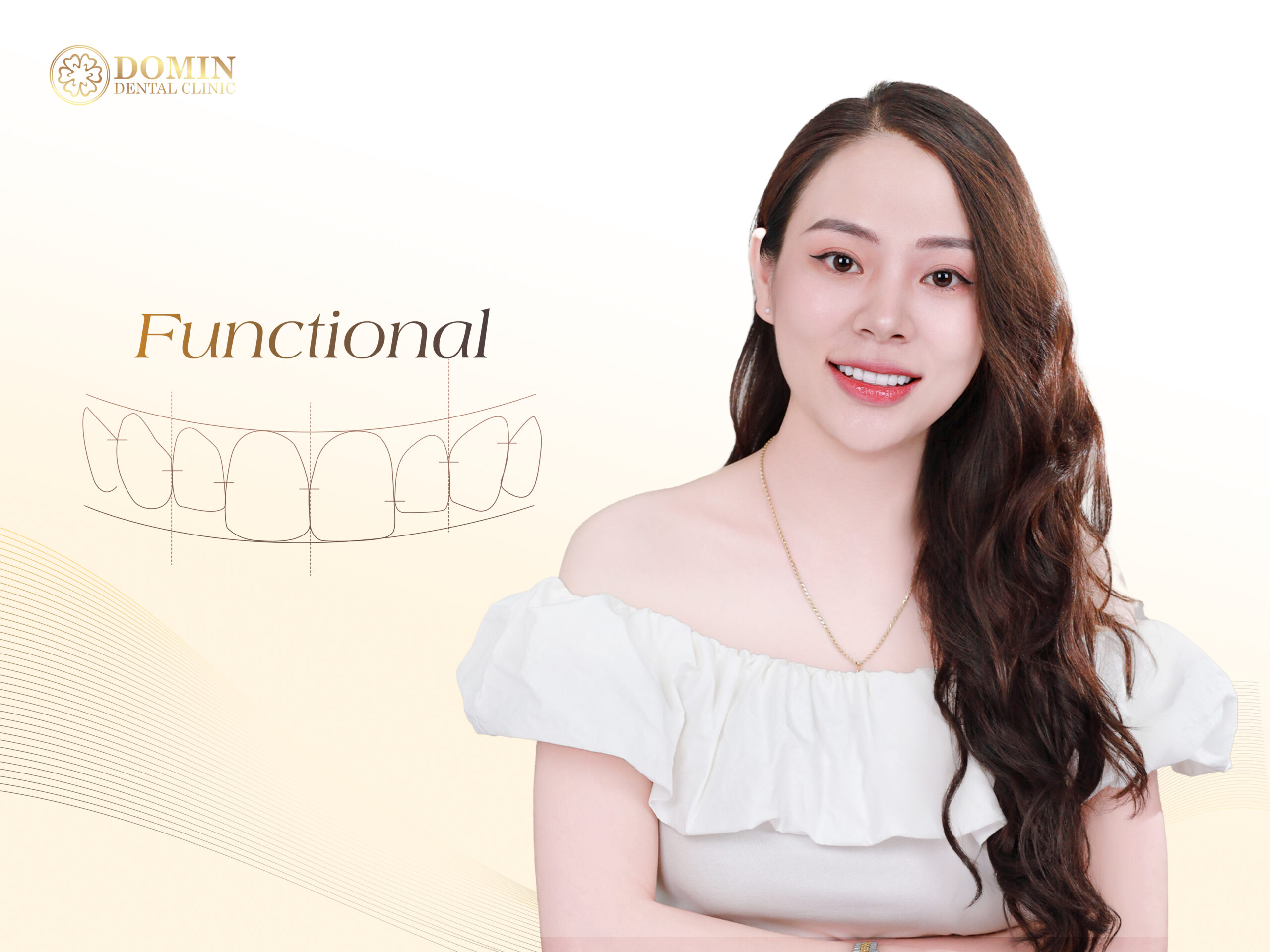 Functional shape - Domin Dental Clinic